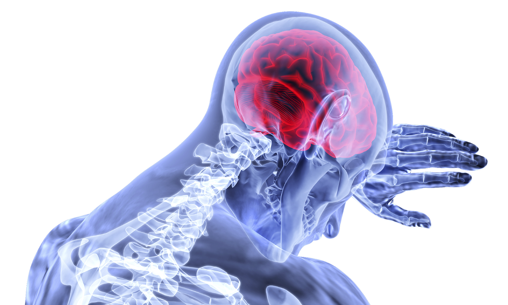 Derrame Cerebral Se ales De Alerta Diagn stico Y Tratamiento Nacion Derrame Cerebral Se ales De Alerta Diagn stico Y Tratamiento Nacion